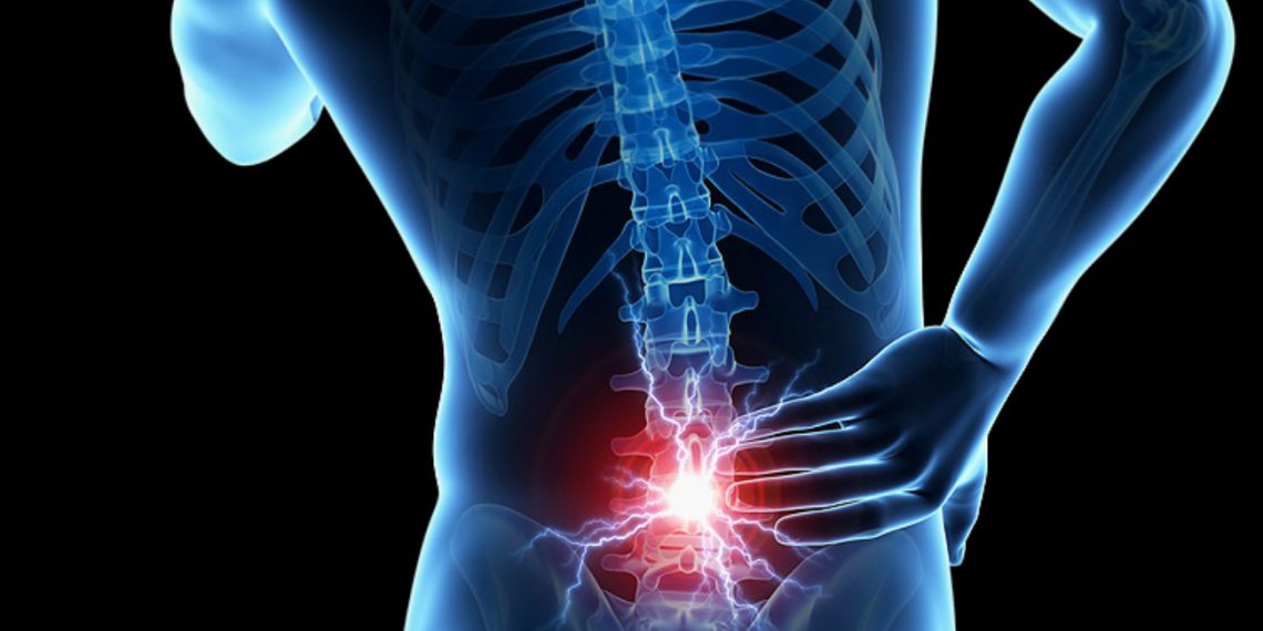 Spinal Injuries Ireland launches its Cauda Equina Syndrome Red Flag ...